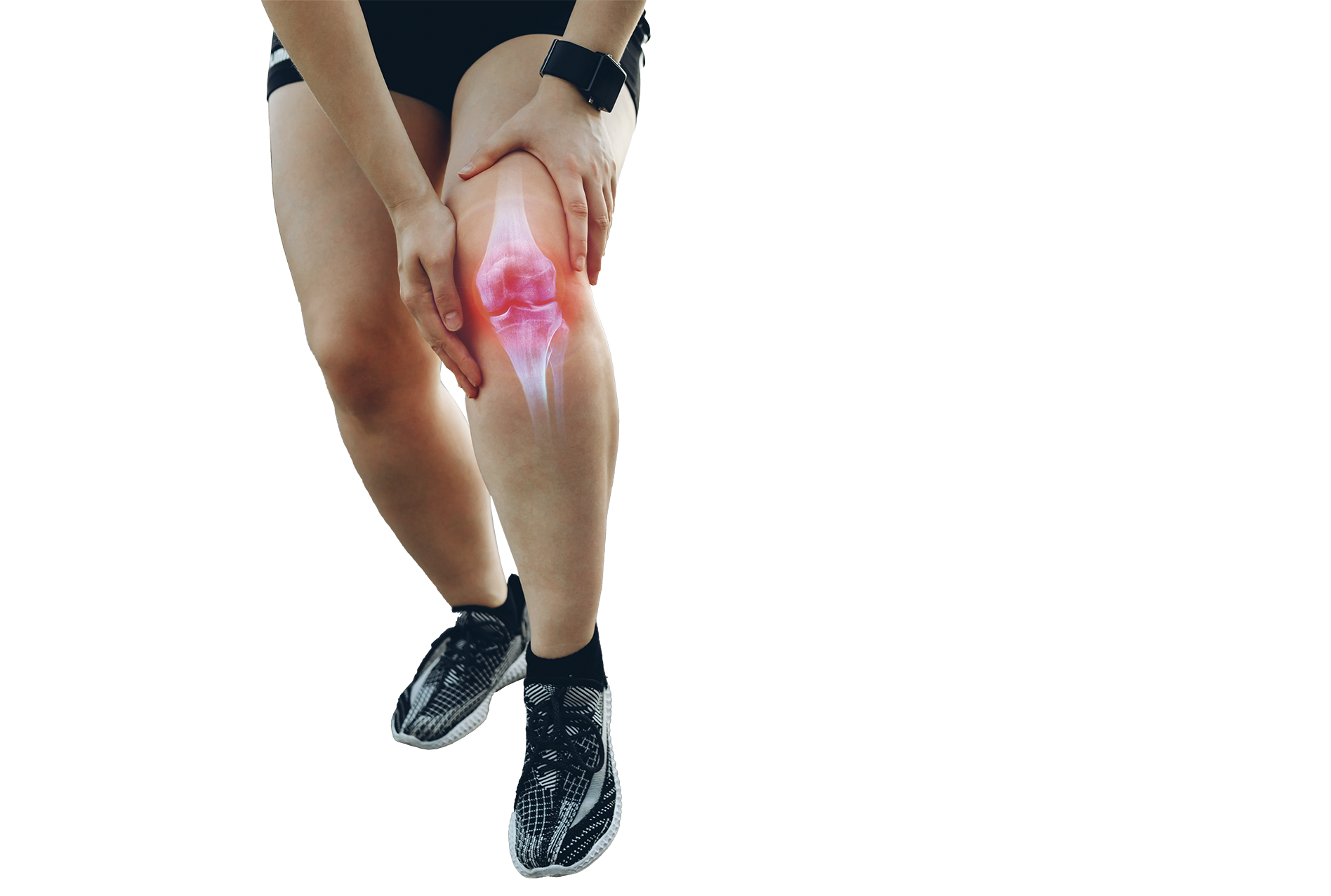 ¿Cuál es el rol del ejercicio en la artrosis de rodilla? ¿Las protege o ...